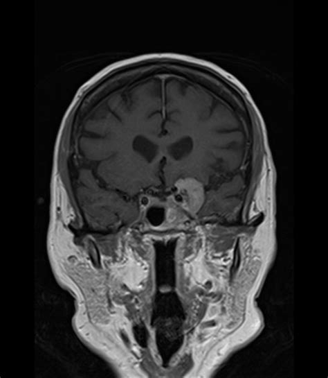 Image Radiopaedia Org