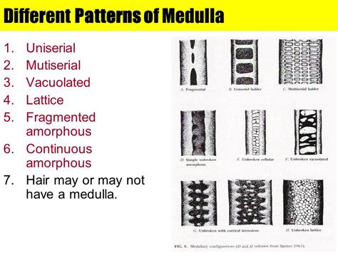 Medulla Patterns