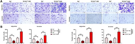 Figure 6 From Lncrna Tusc7 Regulates Oxidative Stress Level By