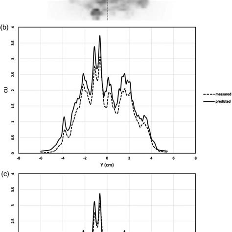 A Composite Portal Dose Image From The Multiple Brain Metastases Download Scientific Diagram