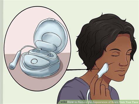 How To Reduce The Appearance Of Scars From Your Face Steps