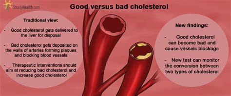 Good And Bad Cholesterol Not As Simple As It Sounds