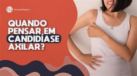 Candidiase axilar um diagnóstico diferencial importante YouTube