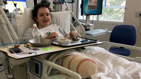 Woman 22 Choses To Have Entire Leg Chopped Off After Getting Suicide