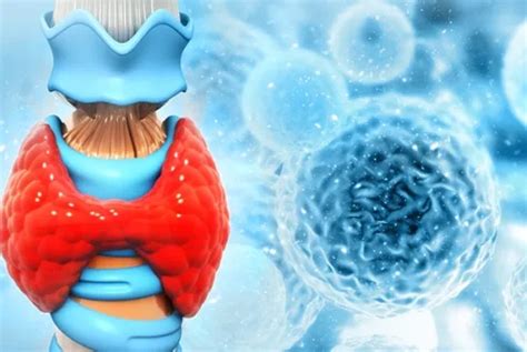 Thyroid Tumor Cancer Yeditepe Üniversitesi Hastanesi