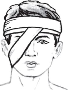 Правила наложения первичных повязок - Организация и безопасность ...