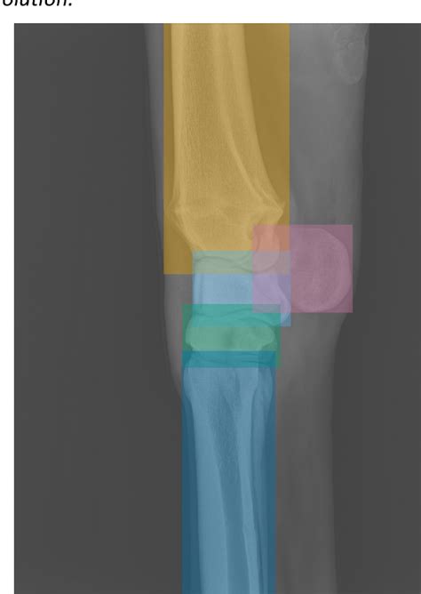 Figure 32 From How Many Radiographs Are Needed To Re Train A Deep Learning System For Object