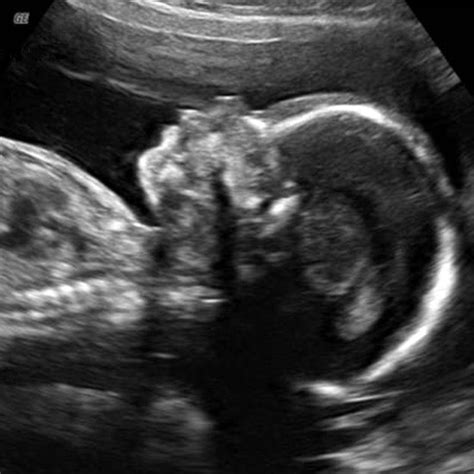 عکس جنین در هفته بیست و یکم بارداری تصویر و اندازه جنین نی نی پلاس