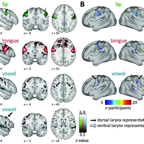 Basic Localizer Task A Whole Brain Group Activation Maps Showing