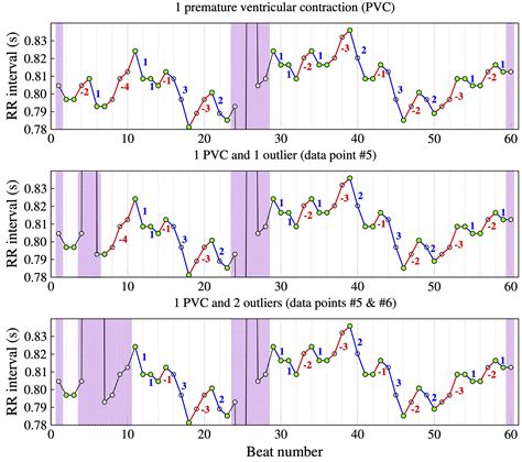 Software For Computing Heart Rate Fragmentation V100