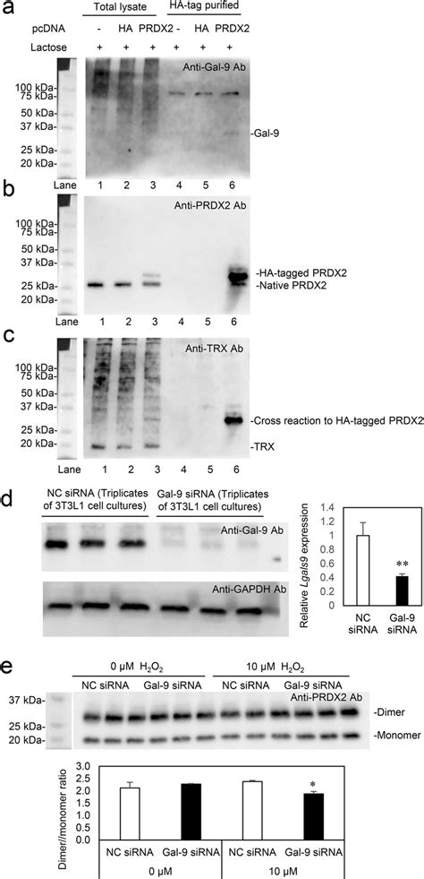 Pull Down Assay And Gal 9 Sirna Experiments In 3t3l1 Cells A