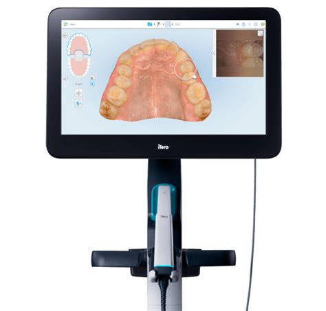 多樣化的口掃機陣容。創造無限可能。