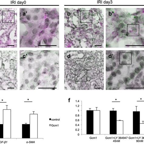 Generation Of Gcm1 Conditional Knockout Cko Mice A Schema Of The