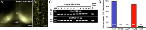 ARC YFP Cells Contain MRNA For Kiss1 And VGluT2 A Photomicrograph Of