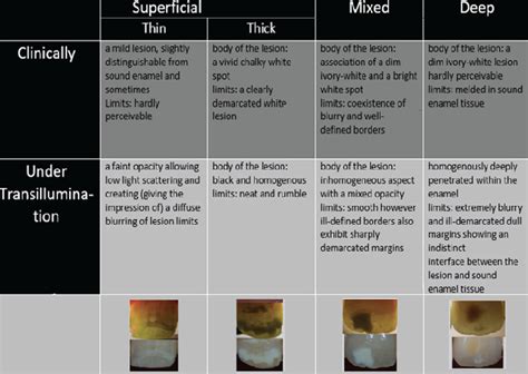 White Spot Lesions A New Topographic Classification