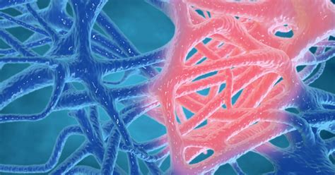 The Relationship Between Inflammation And Depression Psychology Today