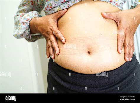 Overweight Asian Woman Use Hand To Squeeze Fat Belly Big Size