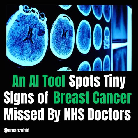 How An Ai Tool Can Detect Breast Cancer Eman Zahid Posted On The