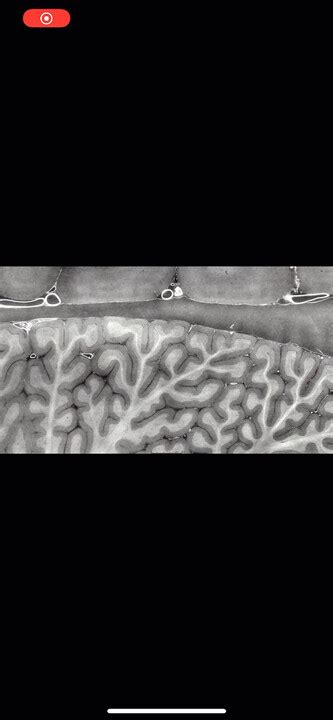 Michael Winer Posted On Linkedin