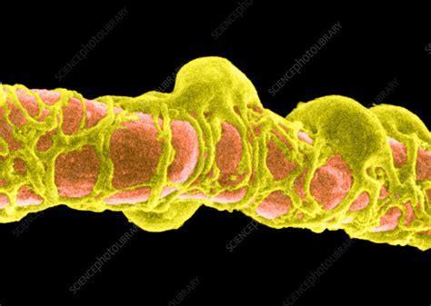 Pericytes Sem Stock Image C0283861 Science Photo Library