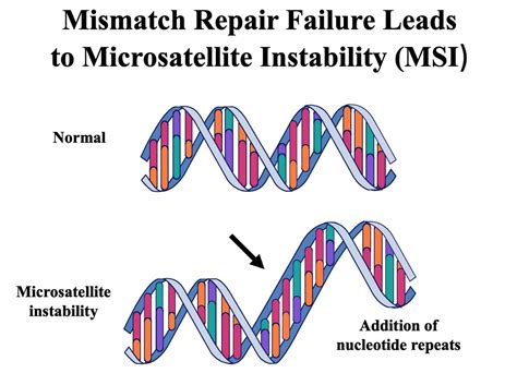 Know What Your Doctor Knows What Is Microsatellite Instability High