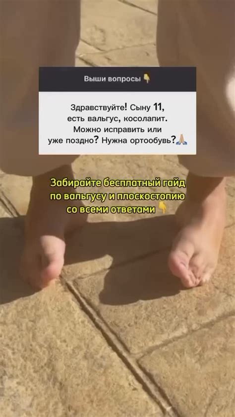 ВАЛЬГУС • ЛФК • ОСАНКА А у вас как🤭 Instagram