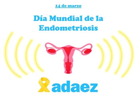 14 De Marzo DÍa Mundial De La Endometriosis Adaena