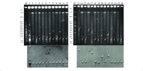 Isolation And Determination Of Plasmids Harboring The Bla Ndm Gene In