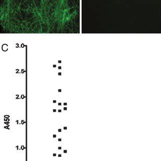 MTP Are Produced During Human TB Infection A IF Showing That MTP Download Scientific Diagram