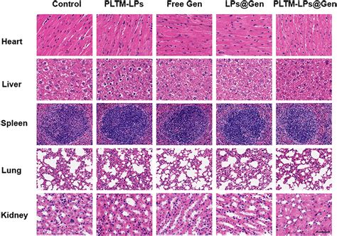 Bio Inspired Nanodelivery Platform Platelet Membrane Cloaked Genistei