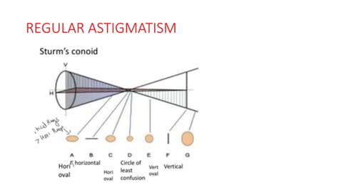 Astigmatism Classification Sturms Conoid Ppt