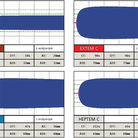 Rotational Thromboelastometry Test During Bleeding From The Respiratory