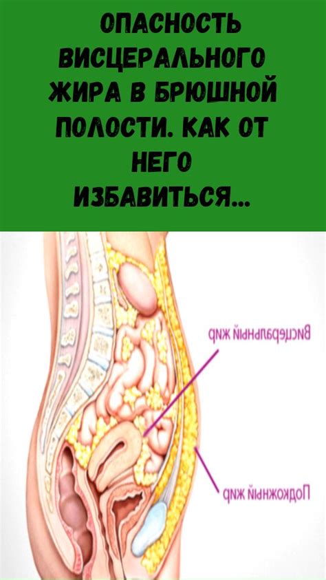 Опасность висцерального жира в брюшной полости Как от него избавиться