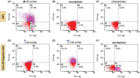 Immunophenotypic Analysis Of Apl And Hla Dr Negative Patients Note