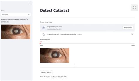 GitHub Shriya02 Coder A Iris A Web App To Accurately Detect Eye