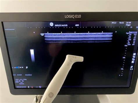 Used Very Good Ge Logiq E10 For Sale Item 1962979 Bimedis