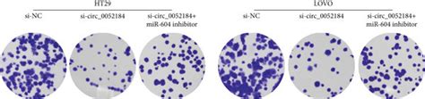 Circ0052184 Regulated Colorectal Cancer Cell Proliferation Migration