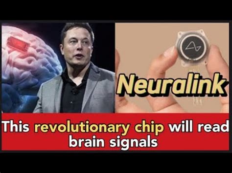Neuralink Human Trials What Exactly Does Neuralink Do And Where Is