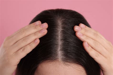 What Is The Role Of Scalp Health In Hair Growth My Derma Store