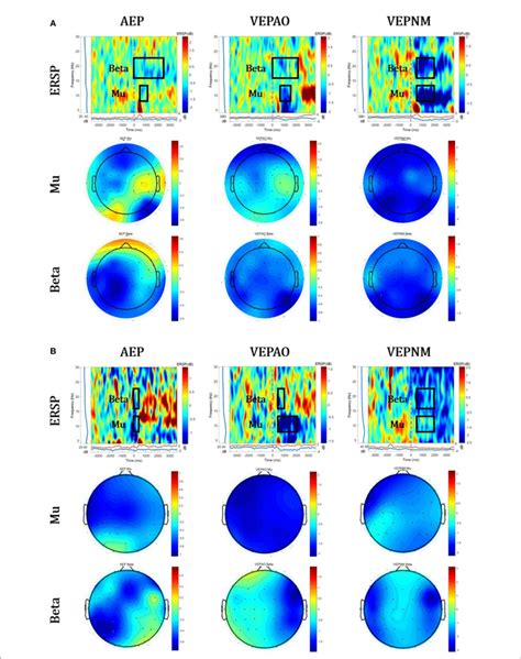 Figure Group Analysis Of Event Related Spectral Perturbation Ersp And