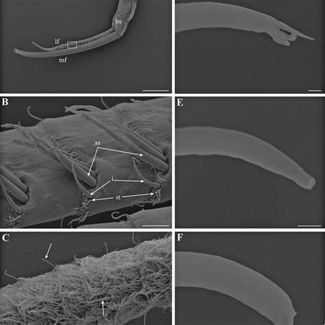 Morphology Of Antennules And Setal Types Of Palaemon Elegans A