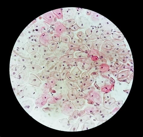 Premium Photo Microscopic View Of Trichomonas Vaginalis In Pap Smear