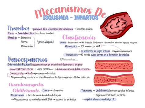 Mecanismo De Isquemia Infarto Med Notes UDocz