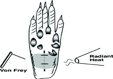 Anesthesiology Anesthesiology