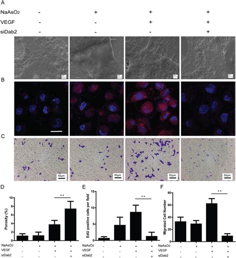 Involvement Of Dab2 In Vegf Receptor Endocytosis Regulating Lsec