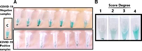 Picture Of A The Positive And Negative Sample Colorimetric Analysis Download Scientific Diagram