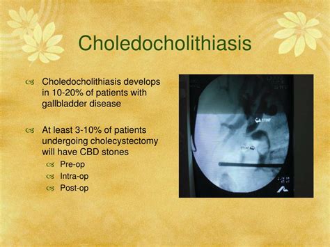 PPT Cholangitis Management Of Choledocholithiasis PowerPoint Presentation ID 4488108