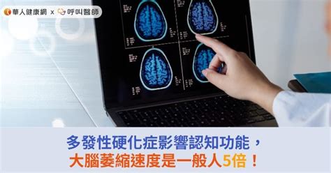 多發性硬化症影響認知功能，大腦萎縮速度是一般人5倍！ 華人健康網 專業即時優質的健康新聞及資訊分享平台業即時優質的健康新聞及資訊分享平台