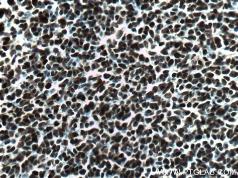 Sox2 Antibody 66411 1 Ig Proteintech