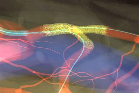 What Can Formula One Teach Us About Improving Advanced Coronary